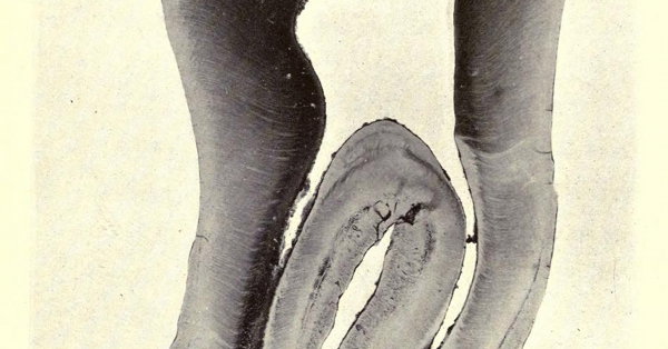 ‘Human Tooth, Vertical Section’ by Arthur E Smith from Nature Through ...