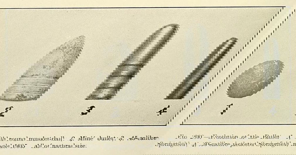 ‘Evolution of the Bullet’ from American Practice of Surgery: A Complete ...