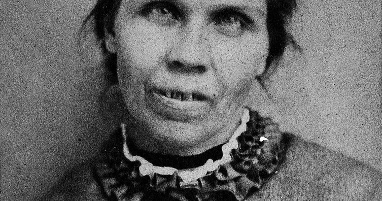 ‘Woman Suffering from Chronic Mania’ by James Crichton-Browne (1869 ...